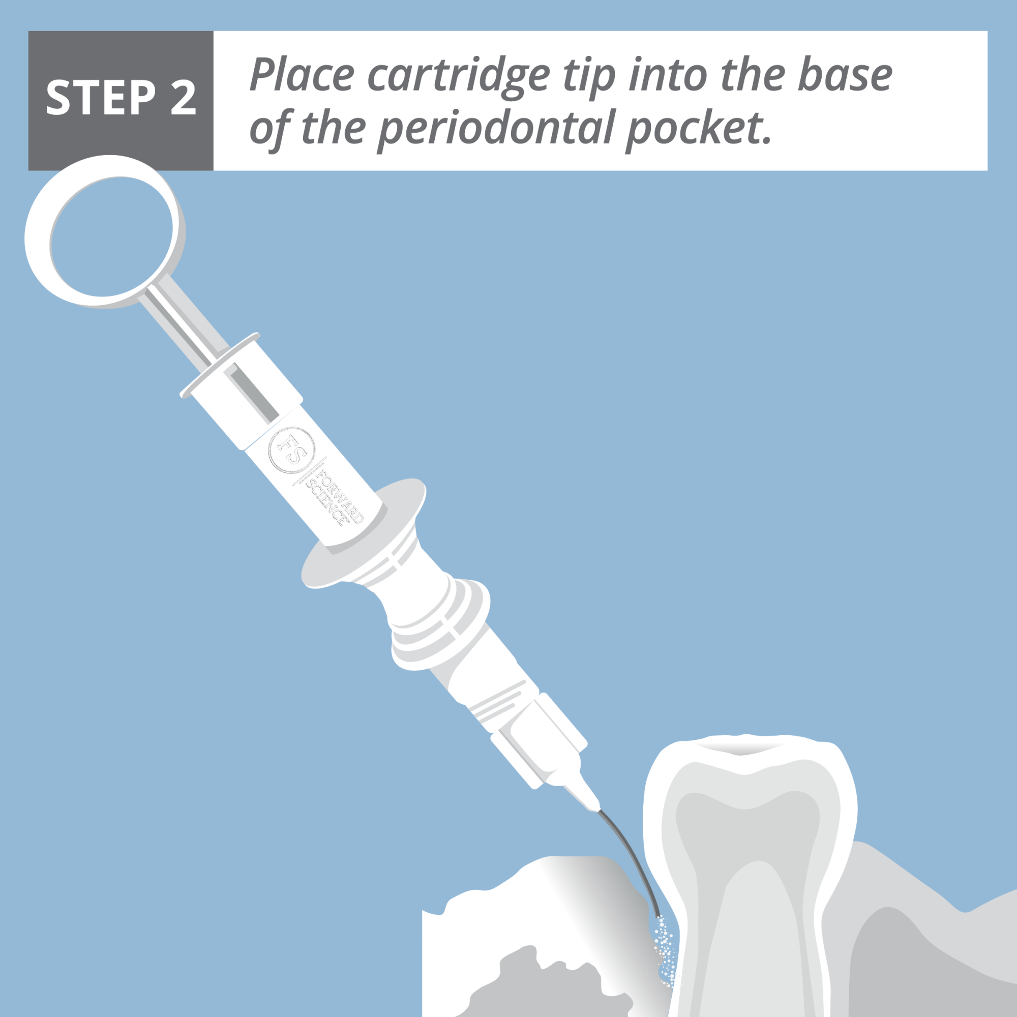 PerioStom | Forward Science