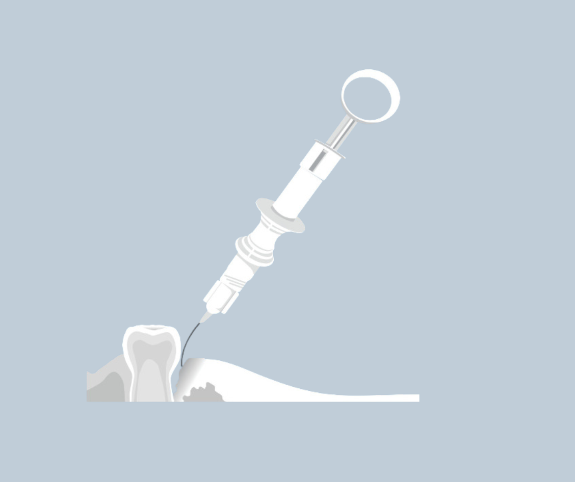 PerioStom | Forward Science